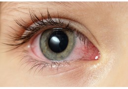 Le CBD peut-il rendre les yeux rouges